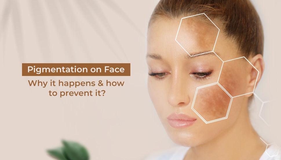Pigmentation on Face: Why It Happens and How to Prevent It? – Indus Valley