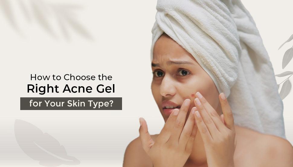 How to Choose the Right Acne Gel for Your Skin Type? – Indus Valley