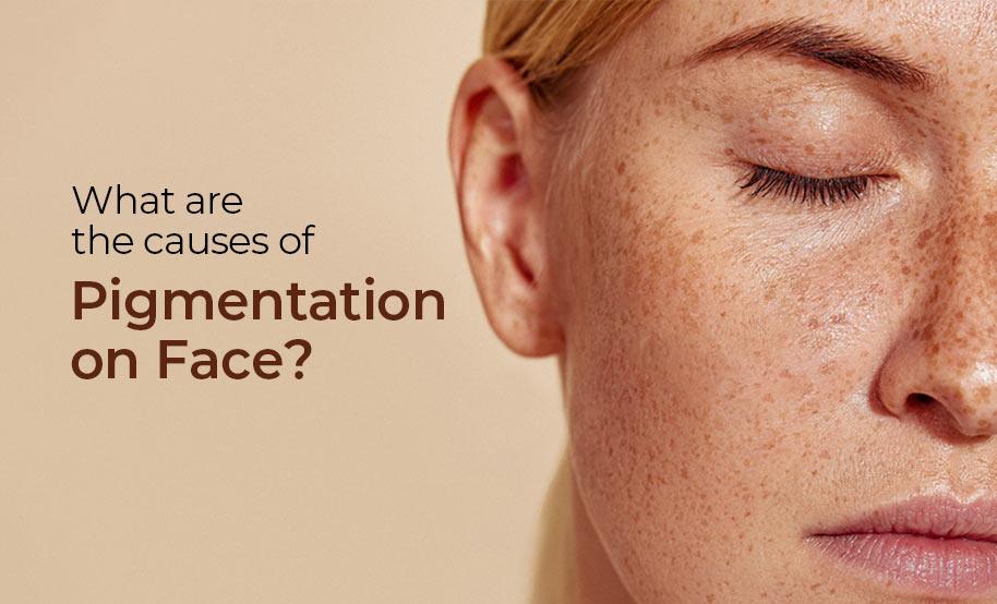 What Are the Causes of Pigmentation on Face? – Indus Valley